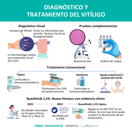 Vitíligo: causas, diagnóstico y tratamiento con Ruxolitinib (Opzelura)
